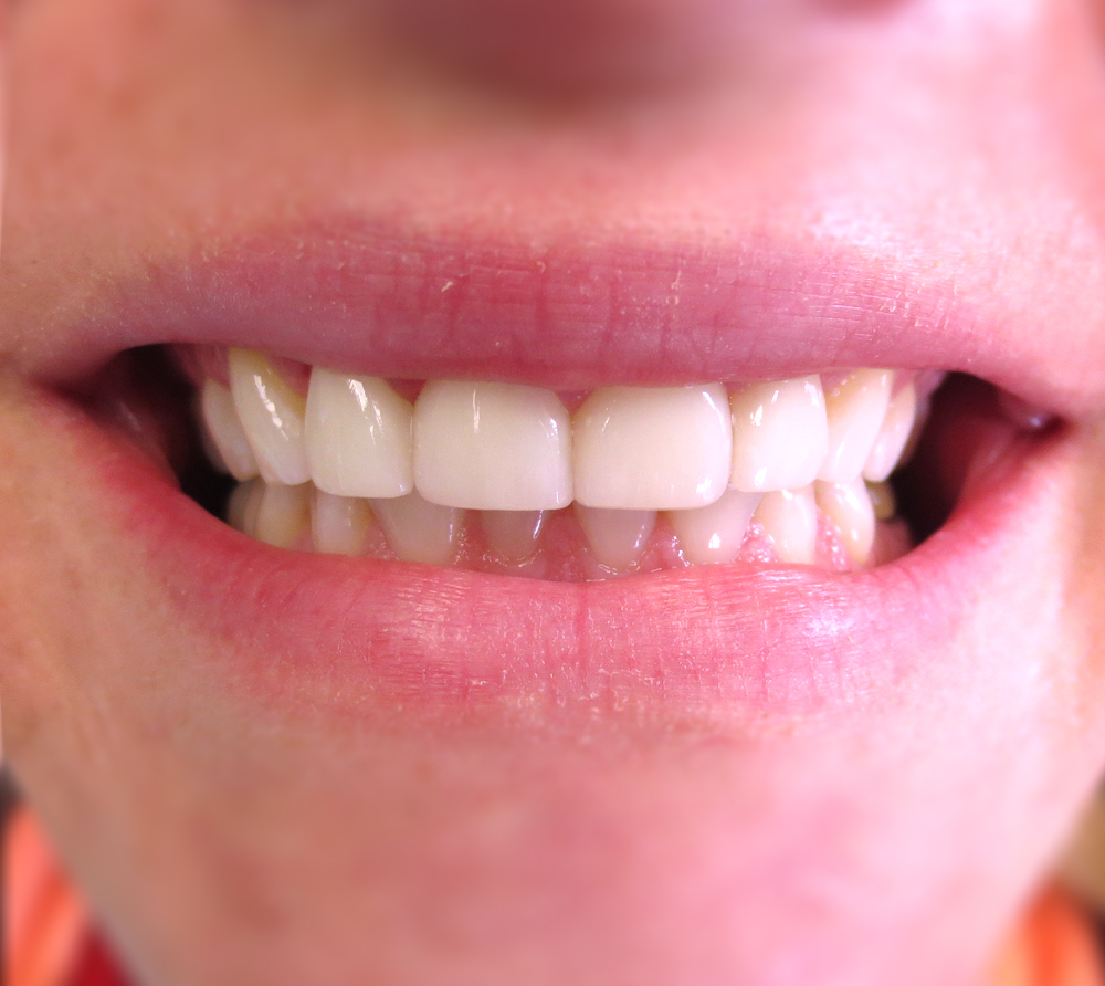 Portfolio - Chester Mendham Dental